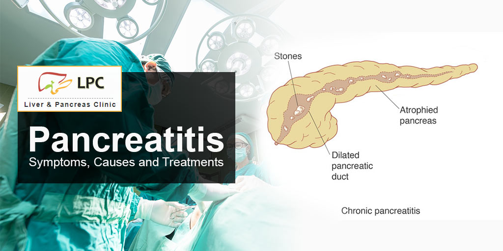 Pancreatitis-Symptoms-Causes-and-Treatments | LPCLPC